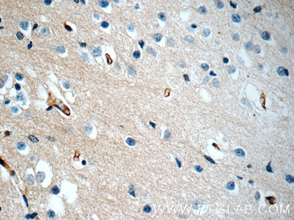 PEX5L Antibody 13084-1-AP | Proteintech