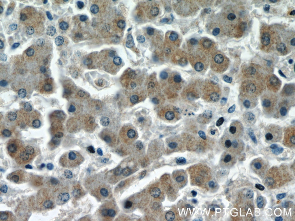 PHLPP antibody (22789-1-AP) | Proteintech