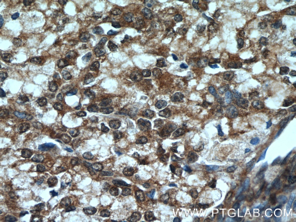 PI3 Kinase p85 Alpha antibody (60225-1-Ig) | Proteintech