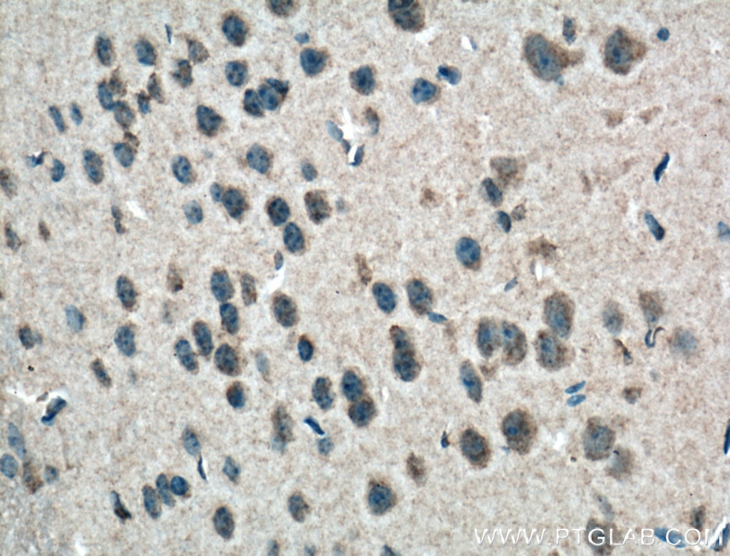 PI3 Kinase p85 Alpha antibody (60225-1-Ig) | Proteintech
