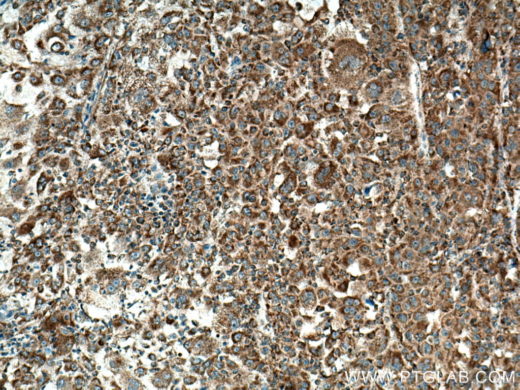 PIN4 antibody (15789-1-AP) | Proteintech