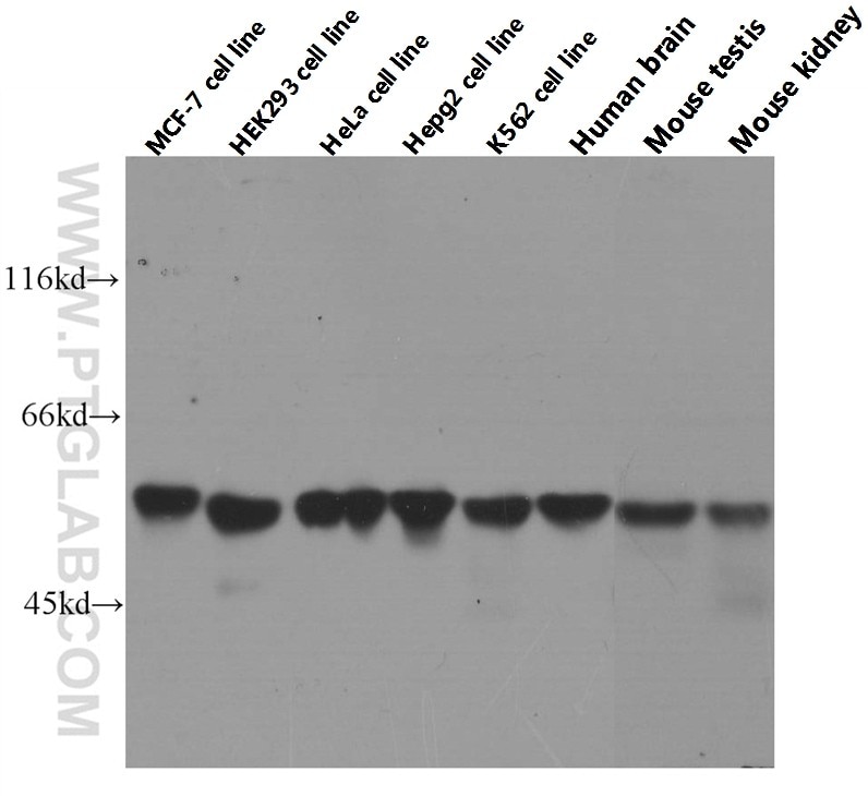 PKM2-specific antibody (60268-1-Ig) | Proteintech