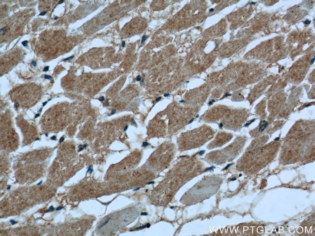 PKM1-specific antibody (15821-1-AP) | Proteintech