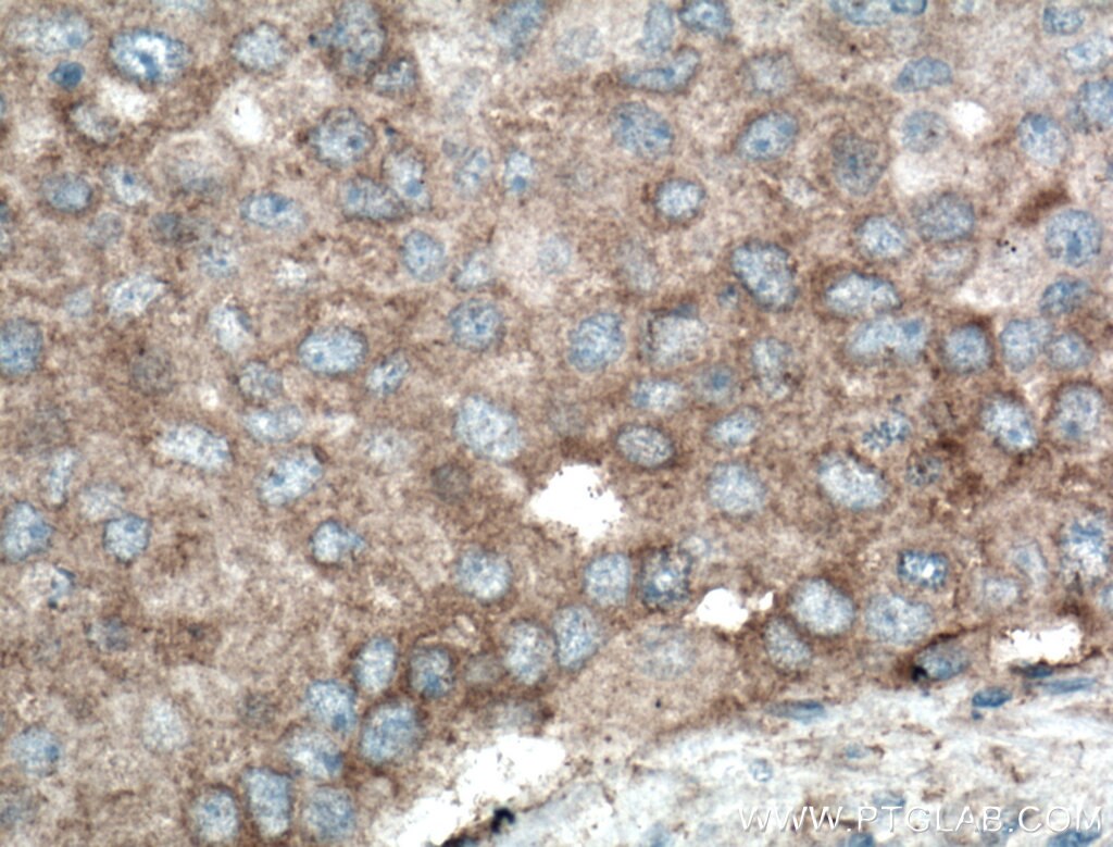 PLEKHM1 antibody (16202-1-AP) | Proteintech