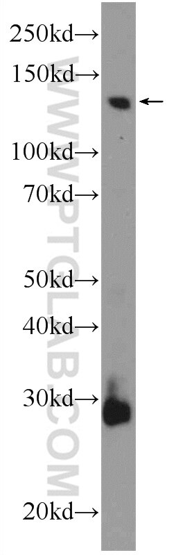 Pinin Antibody 18266-1-AP | Proteintech