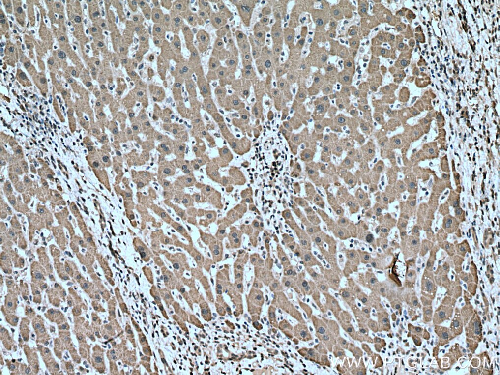 PPIL3 Antibody 15671-1-AP | Proteintech