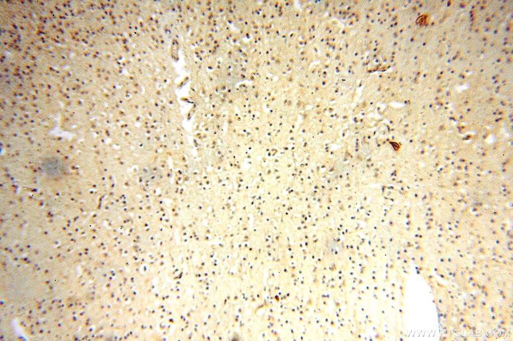 PPIL3 Antibody 15671-1-AP | Proteintech