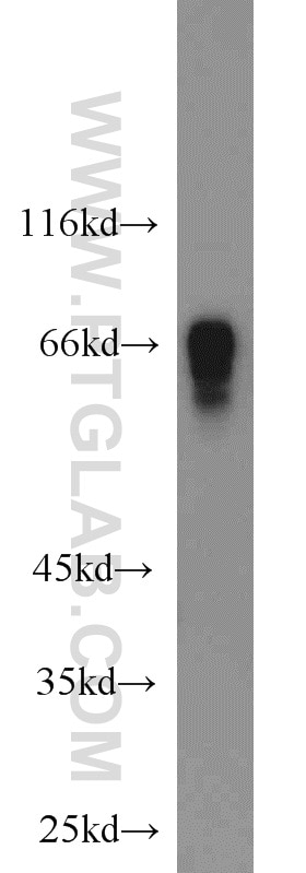 PRC1 Antibody 10110-2-AP | Proteintech
