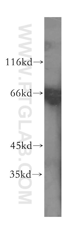 PRC1 Antibody 15617-1-AP | Proteintech