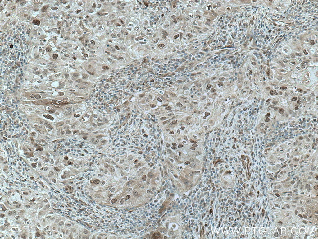 PRC1 antibody (67027-1-Ig) | Proteintech