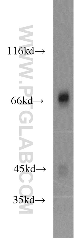 PKC Delta Antibody 14188-1-AP | Proteintech