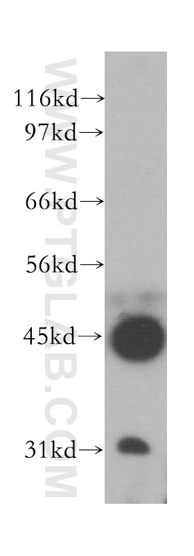 PRMT8 Antibody 12557-1-AP | Proteintech