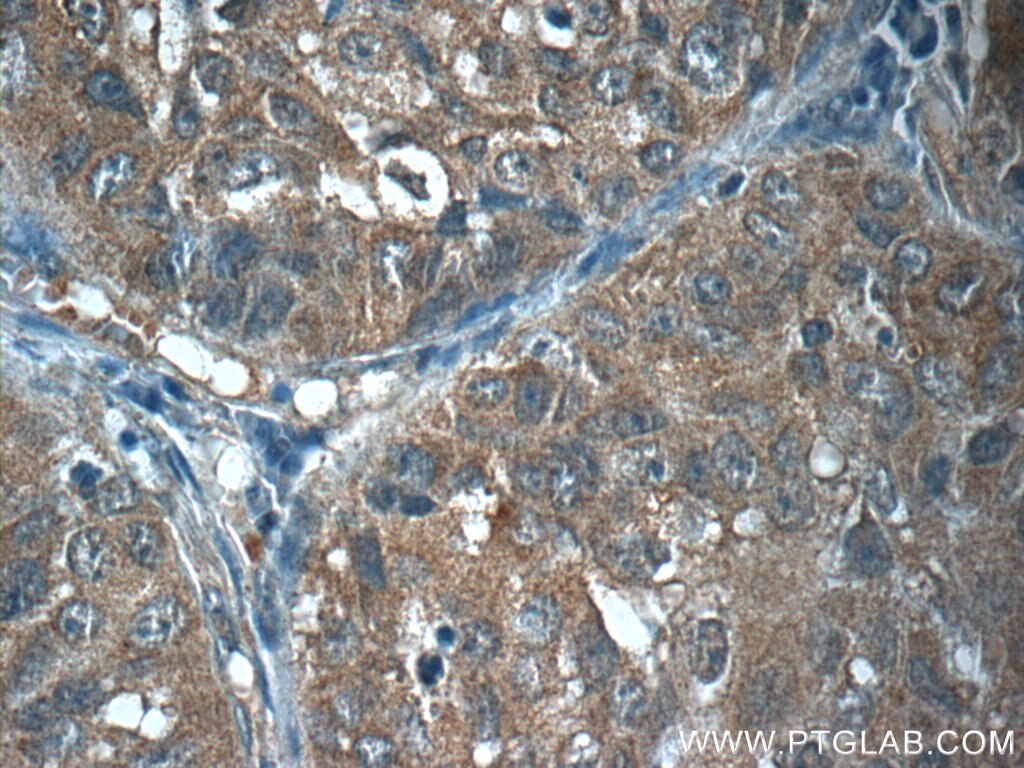 PRDX3 Antibody 10664-1-AP | Proteintech