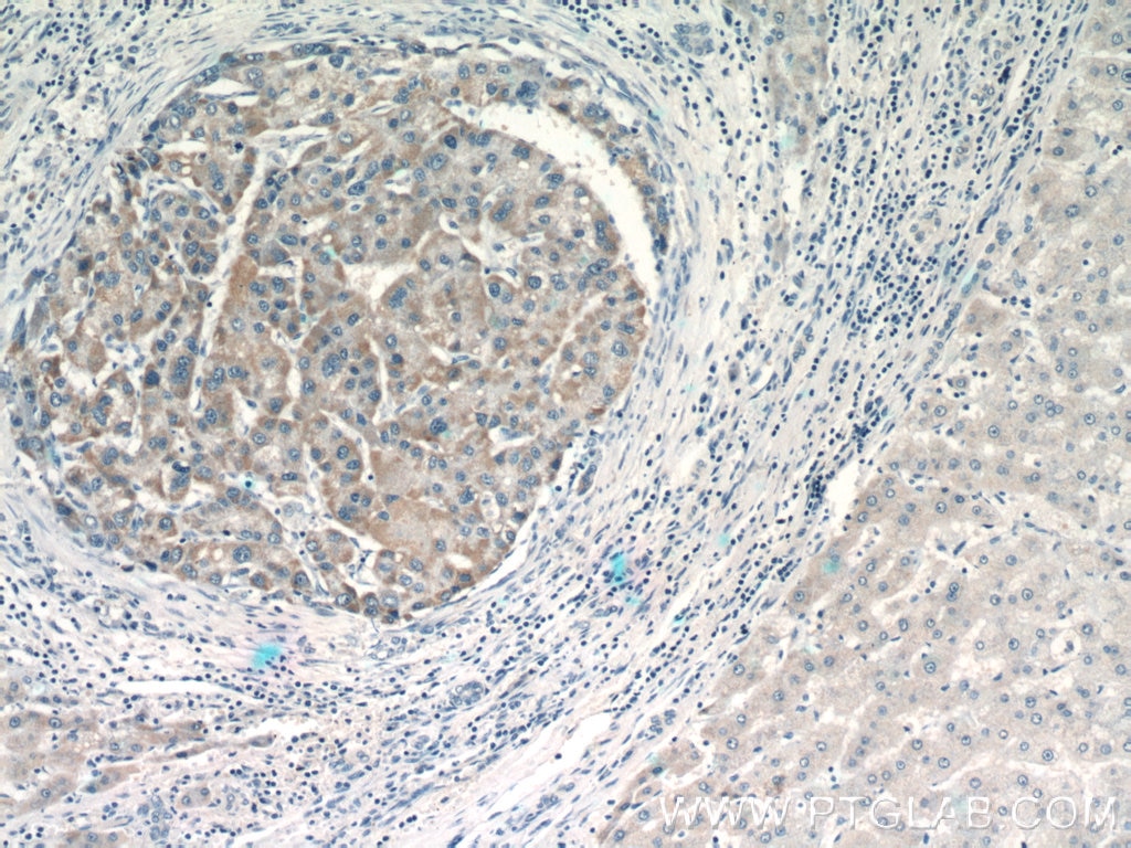 PRDX3 Antibody 10664-1-AP | Proteintech