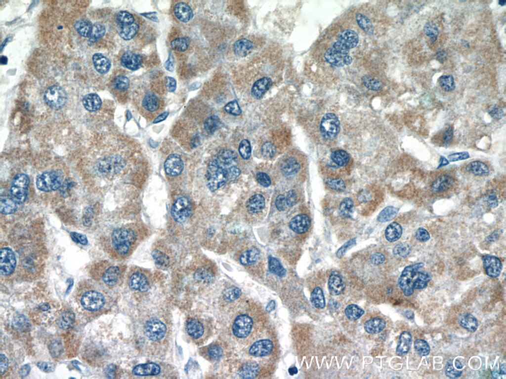 PRDX3 Antibody 10664-1-AP | Proteintech