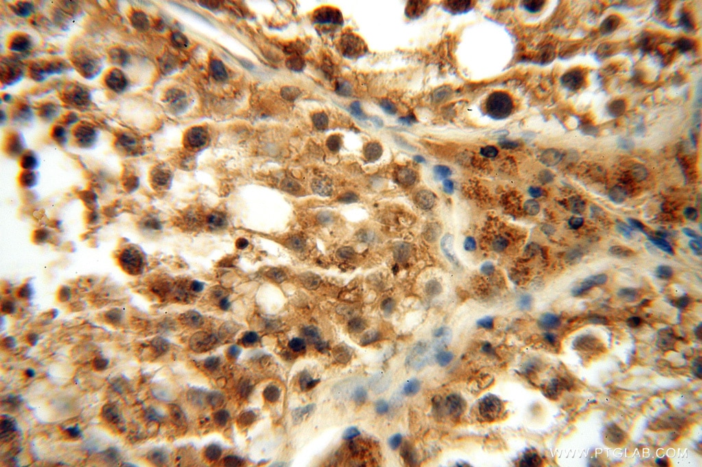 PSAP Antibody 10801-1-AP | Proteintech