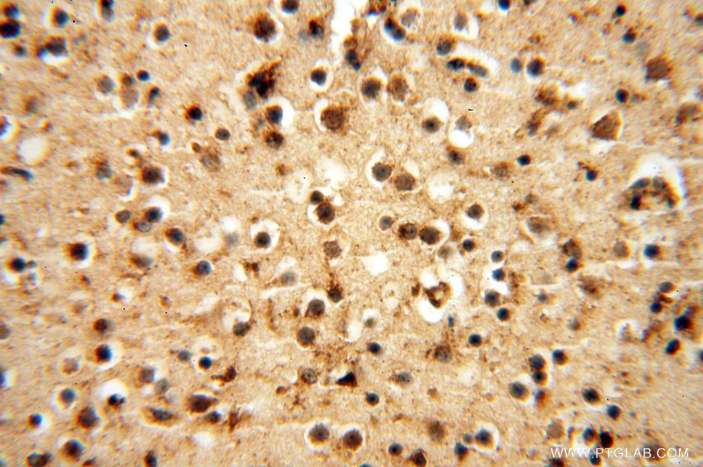 PSAP Antibody 10801-1-AP | Proteintech
