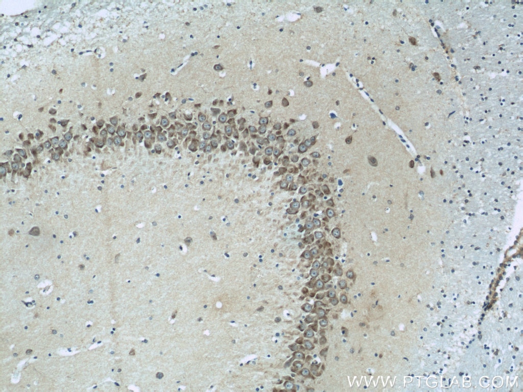 PSD95-Specific,DLG4 Antibody 20665-1-AP | Proteintech