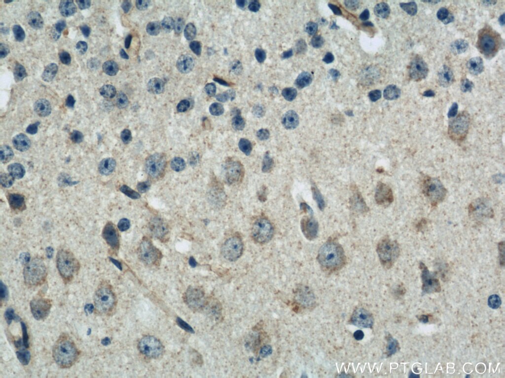 PSD95-Specific,DLG4 Antibody 20665-1-AP | Proteintech