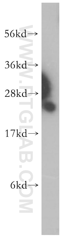 PSMB1 Antibody 11749-1-AP | Proteintech