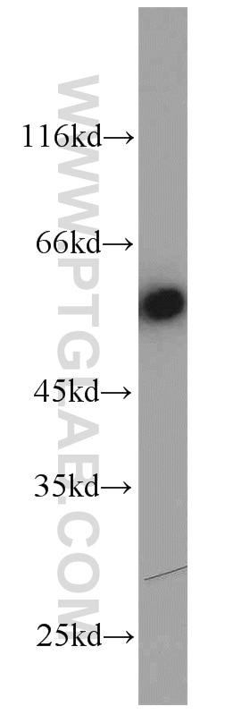 PSMD4 Antibody 14899-1-AP | Proteintech