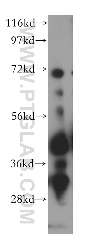 PTPN7 Antibody 15286-1-AP | Proteintech