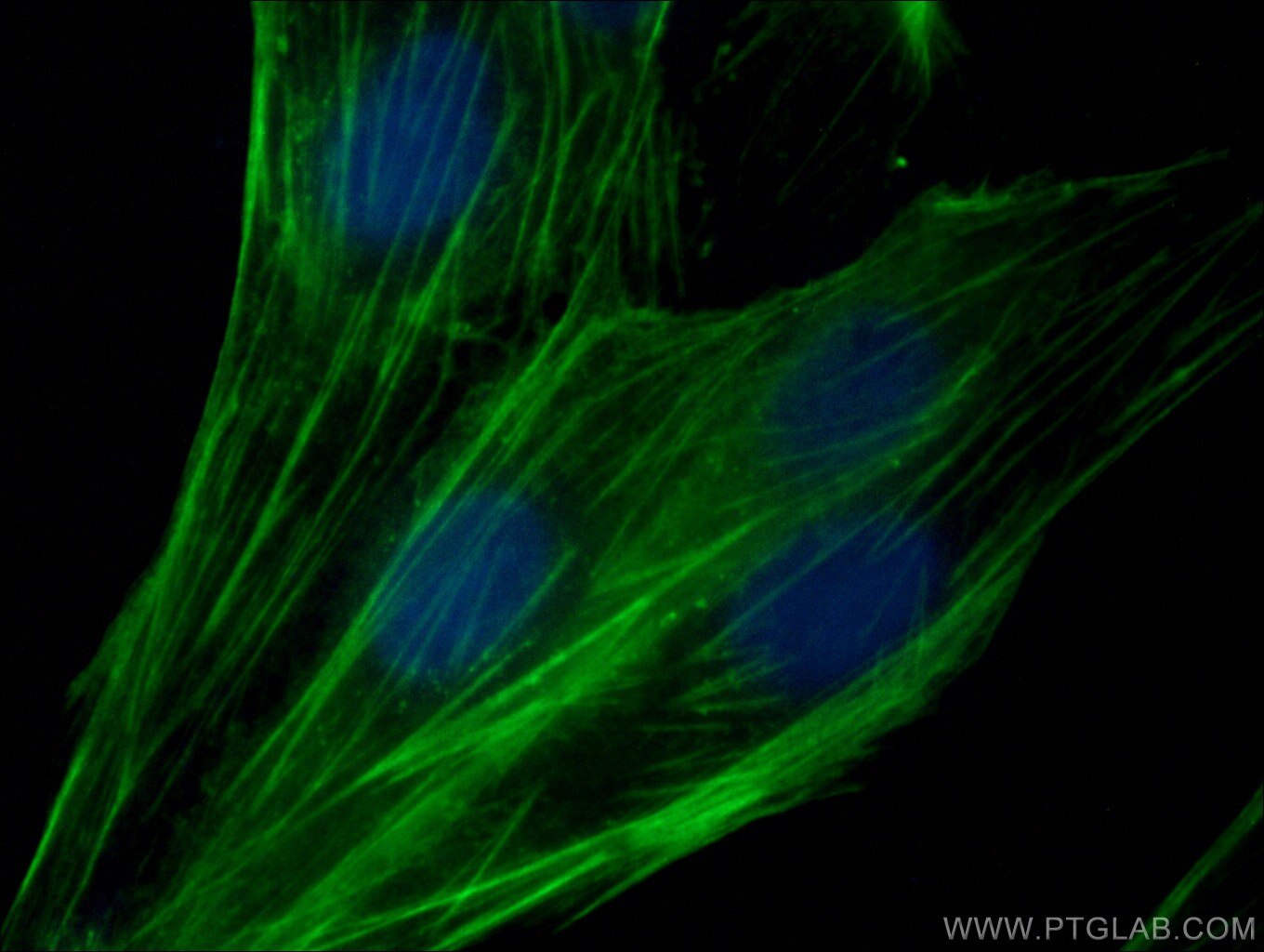 Beta Actin Antibody (66009-1-Ig) | Proteintech