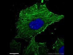 Lysate Preparation: Why is RIPA Buffer Best for Western Blot ...