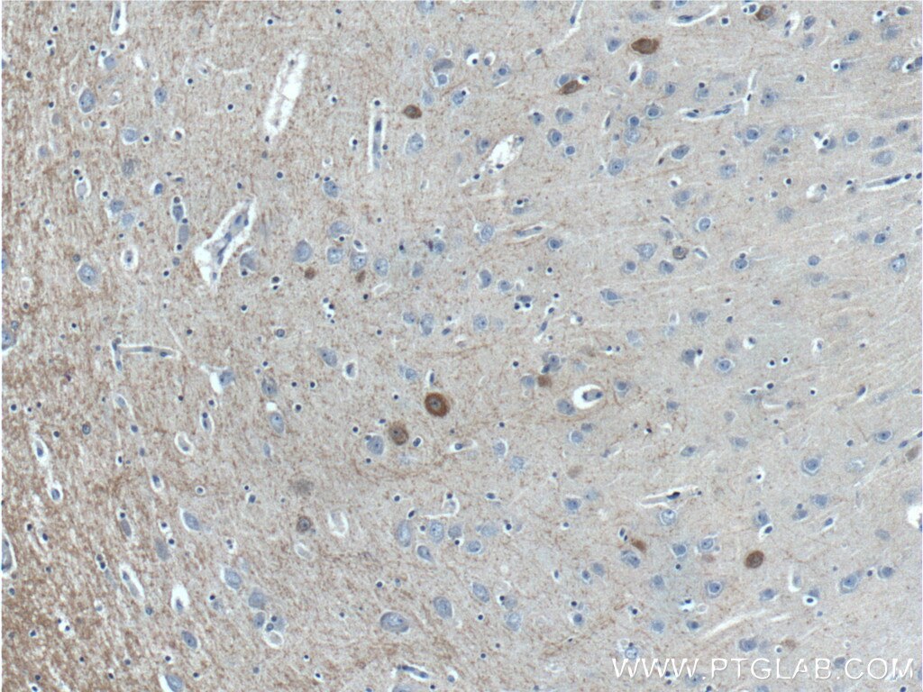 Parvalbumin antibody (26521-1-AP) | Proteintech