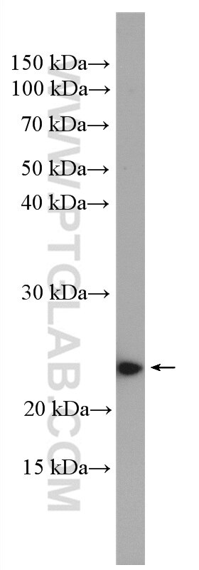 RAB10 antibody (11808-1-AP) | Proteintech