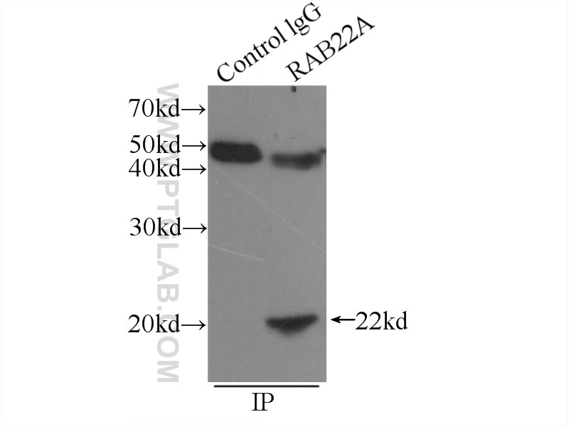 RAB22A Antibody 12125-1-AP | Proteintech