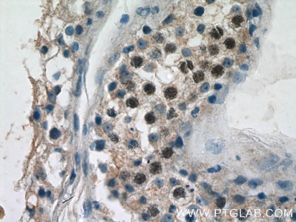 RAD51 Antibody 14961-1-AP | Proteintech