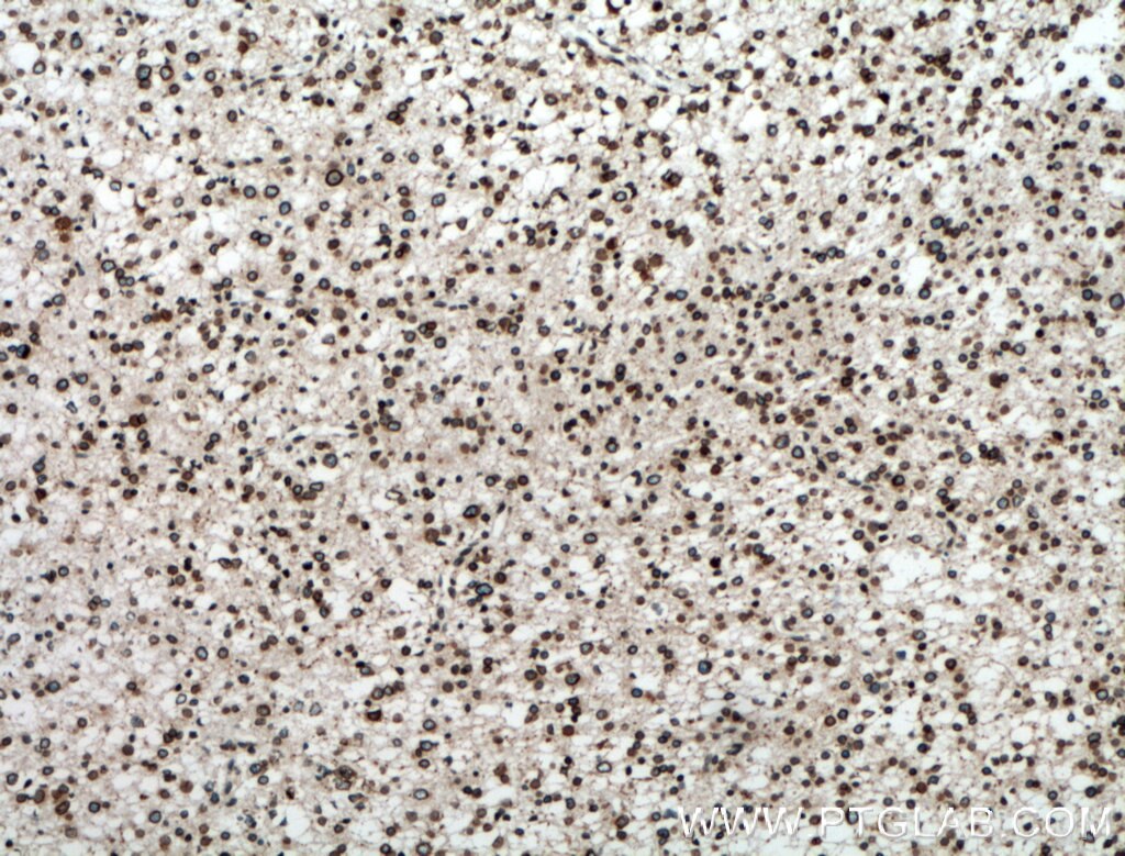 RanGAP1 antibody (11102-1-AP) | Proteintech