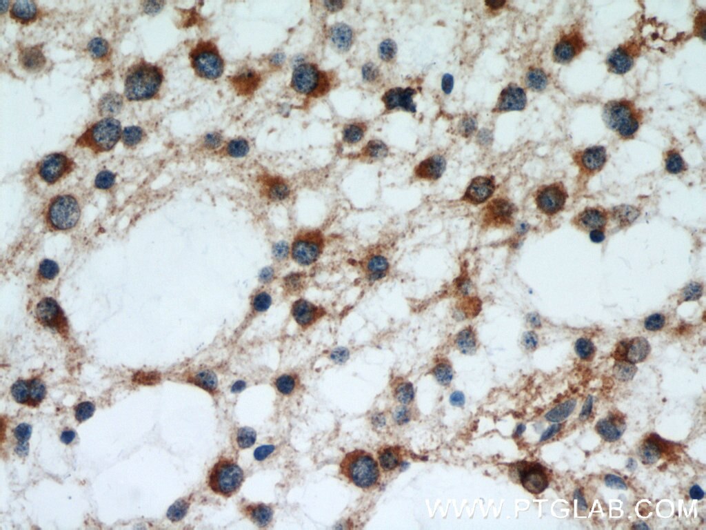 RCN2 antibody (10193-2-AP) | Proteintech
