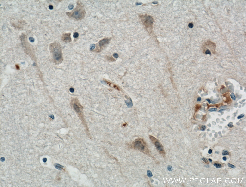 RGMA antibody (12387-1-AP) | Proteintech