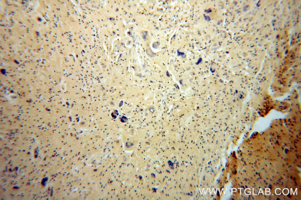 RHOB Antibody 14326-1-AP | Proteintech
