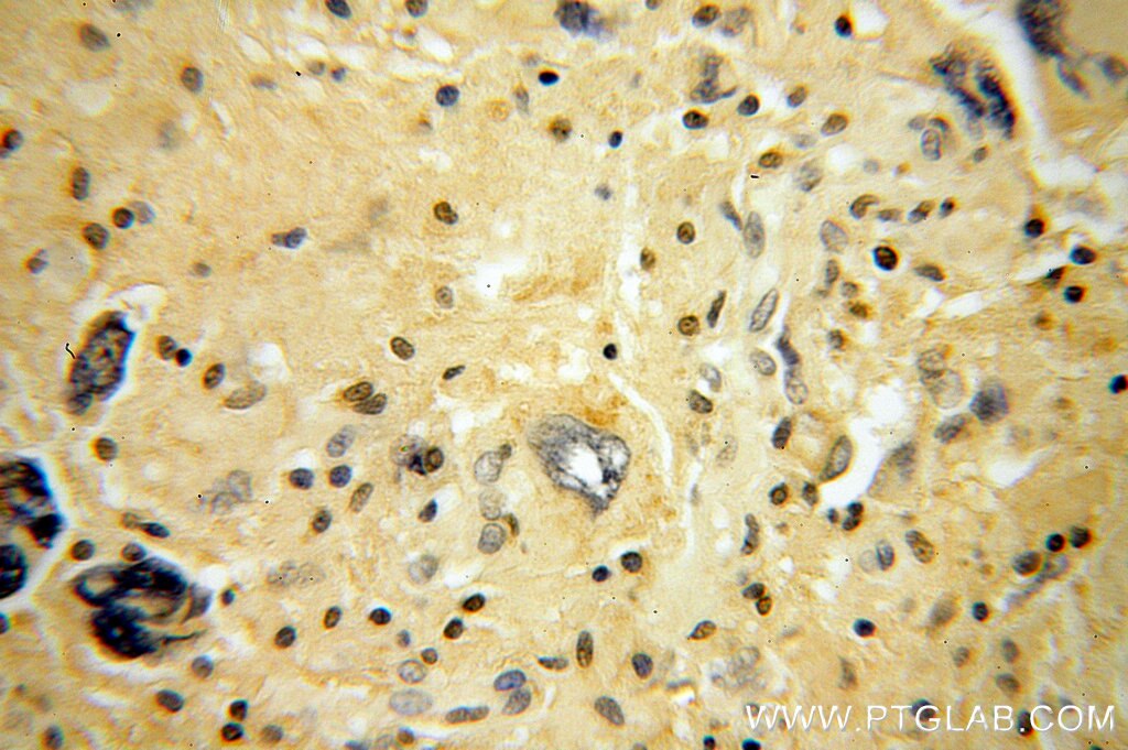 RHOB Antibody 14326-1-AP | Proteintech