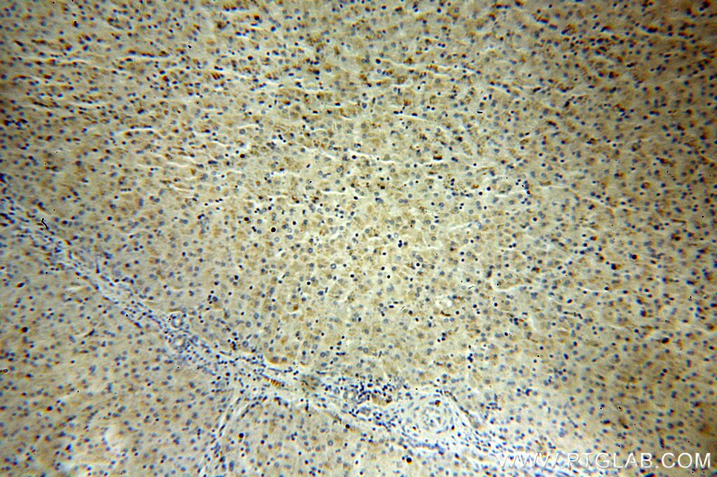 RHOB Antibody 14326-1-AP | Proteintech