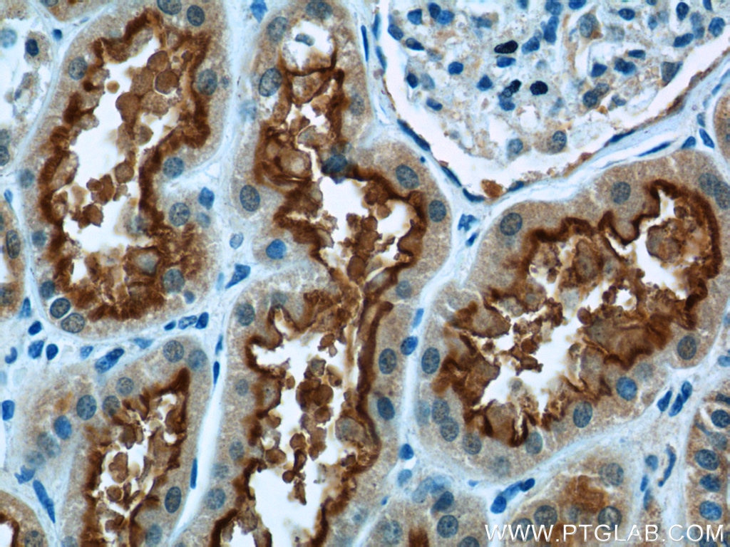 RIMBP2 Antibody 15716-1-AP | Proteintech