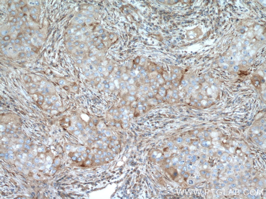 RIOK3 antibody (13593-1-AP) | Proteintech