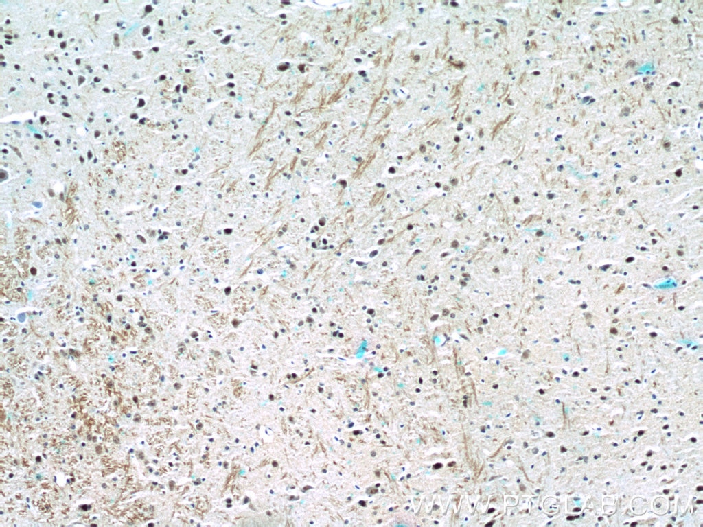 RORB Antibody 17635-1-AP | Proteintech