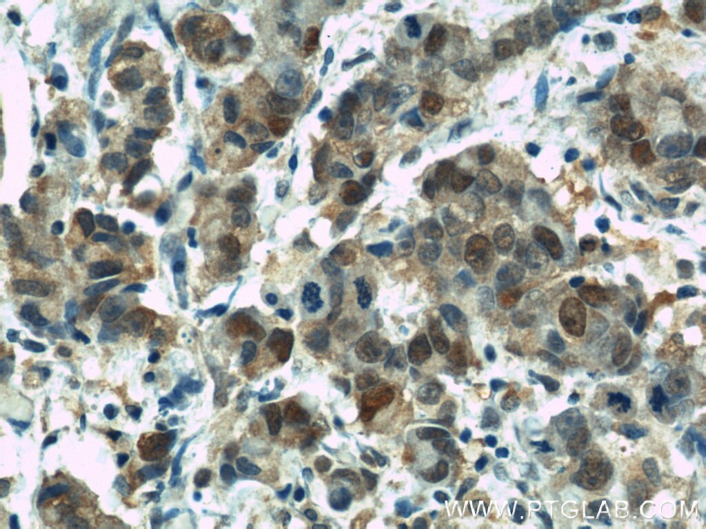 RPL3 antibody (11005-1-AP) | Proteintech