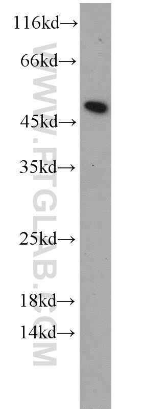 RPL3 antibody (11005-1-AP) | Proteintech