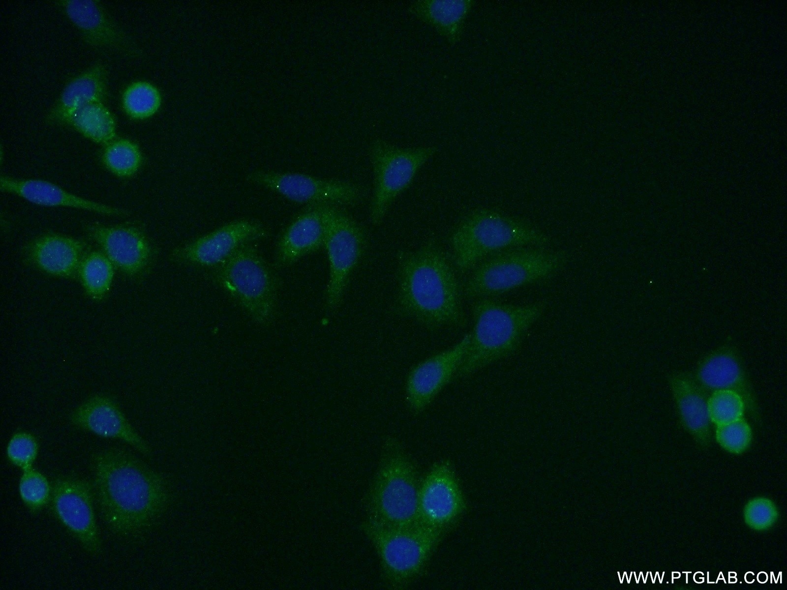 RPL5 Antibody 15430-1-AP | Proteintech