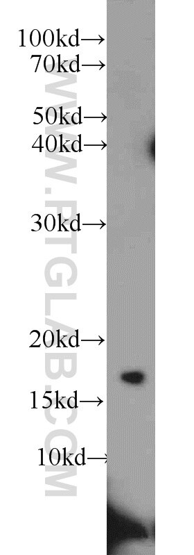 RPS25 Antibody 23599-1-AP | Proteintech