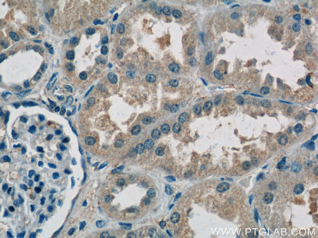 RPS26 antibody (14909-1-AP) | Proteintech