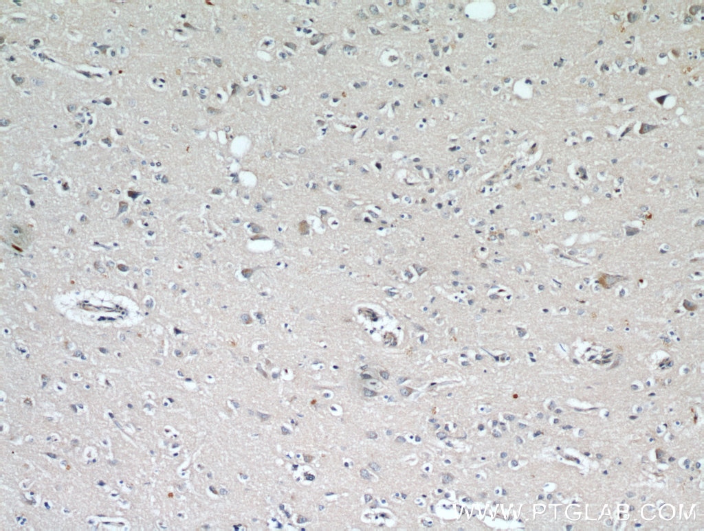 RYR2 antibody (19765-1-AP) | Proteintech