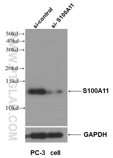 S100A11 antibody (10237-1-AP) | Proteintech