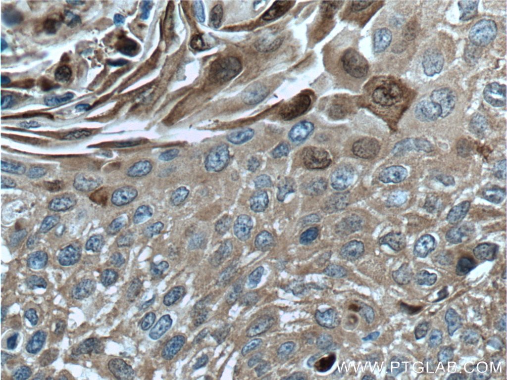 S100A9 antibody (26992-1-AP) | Proteintech
