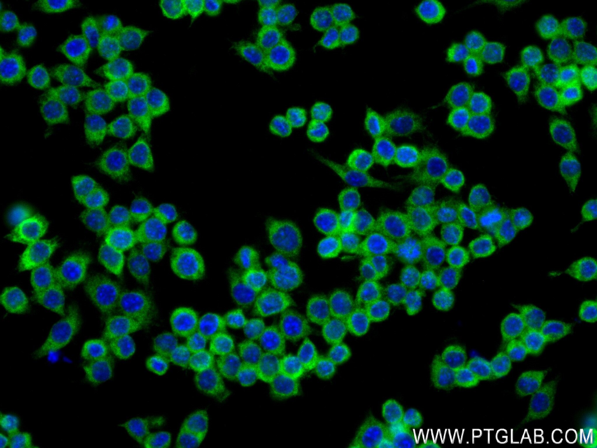 S100A9 antibody (83578-6-RR) | Proteintech